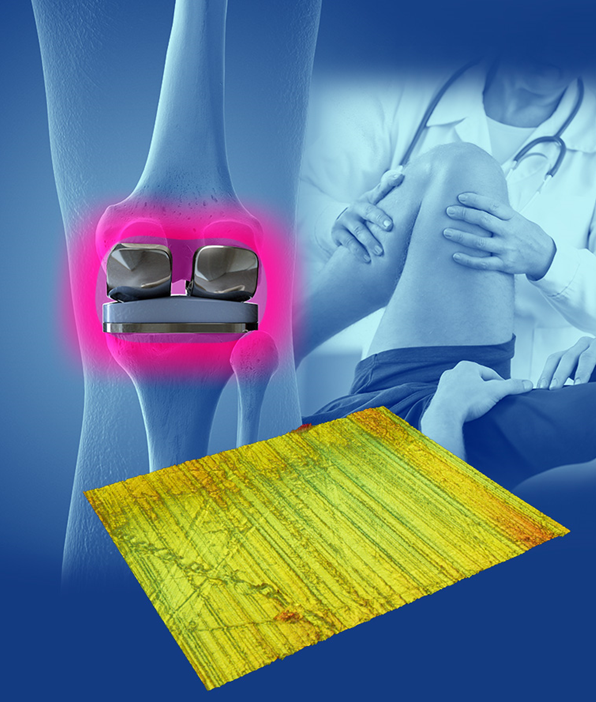 Surface Characterization of Medical Devices; Bridging metrology and ...